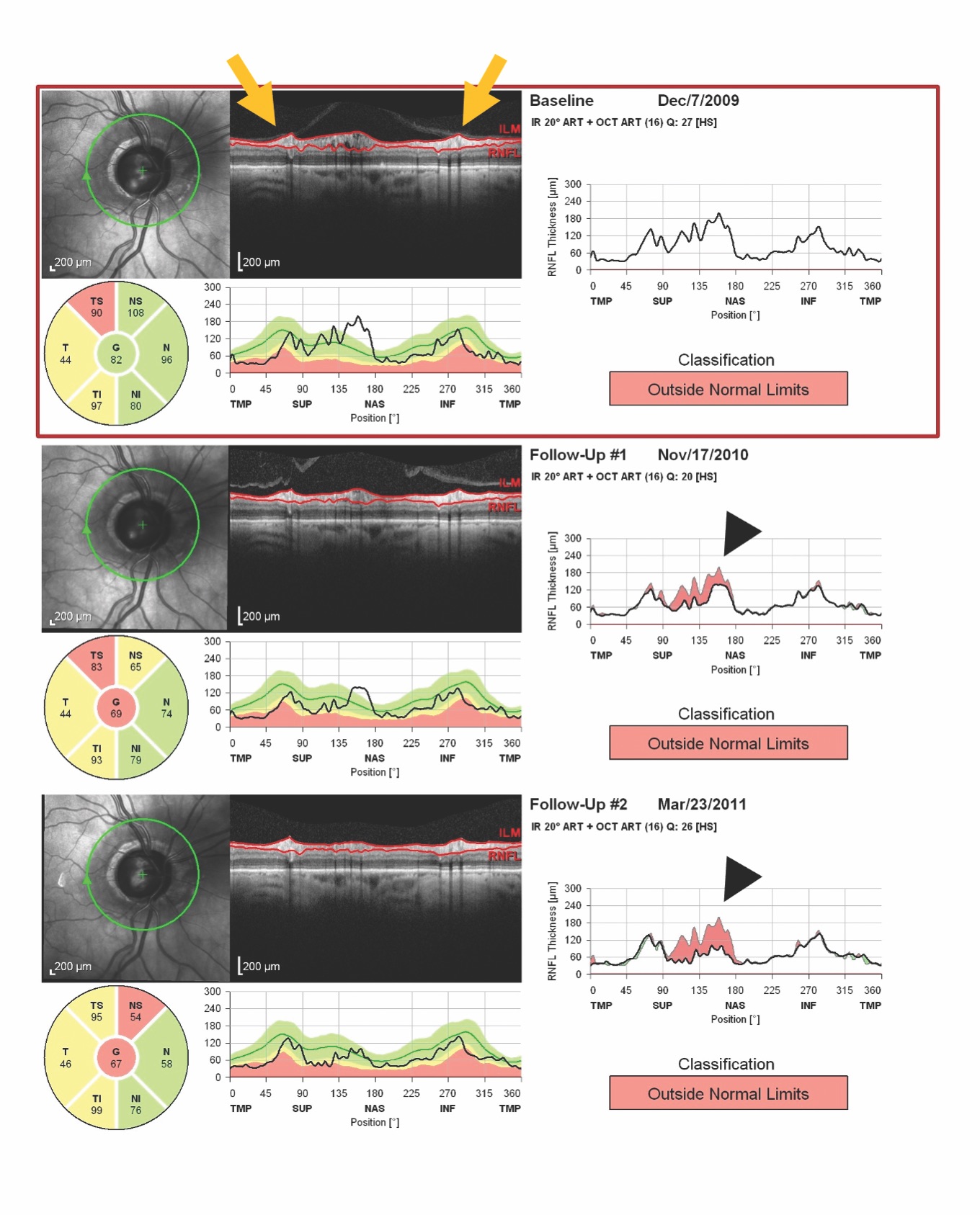 Glaucoma Physician | PentaVision