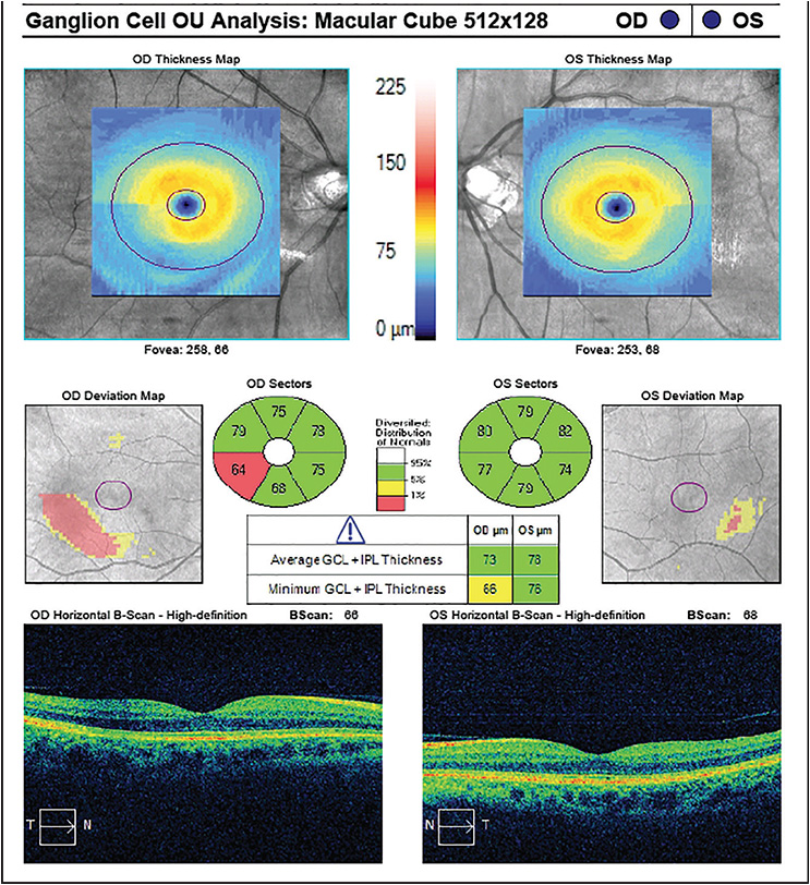 Glaucoma Physician | PentaVision