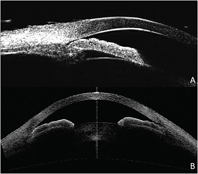 Glaucoma Physician | PentaVision