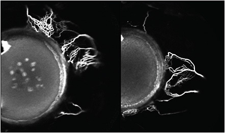 Ocular Blood and Aqueous Flow in Relation to Development of Open-angle ...
