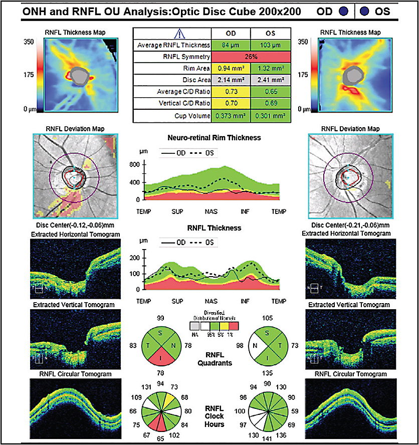 Glaucoma Physician | PentaVision