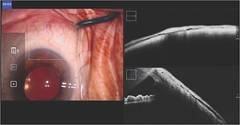 Glaucoma Physician | PentaVision