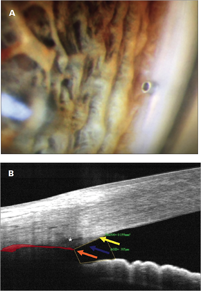 Glaucoma Physician | PentaVision