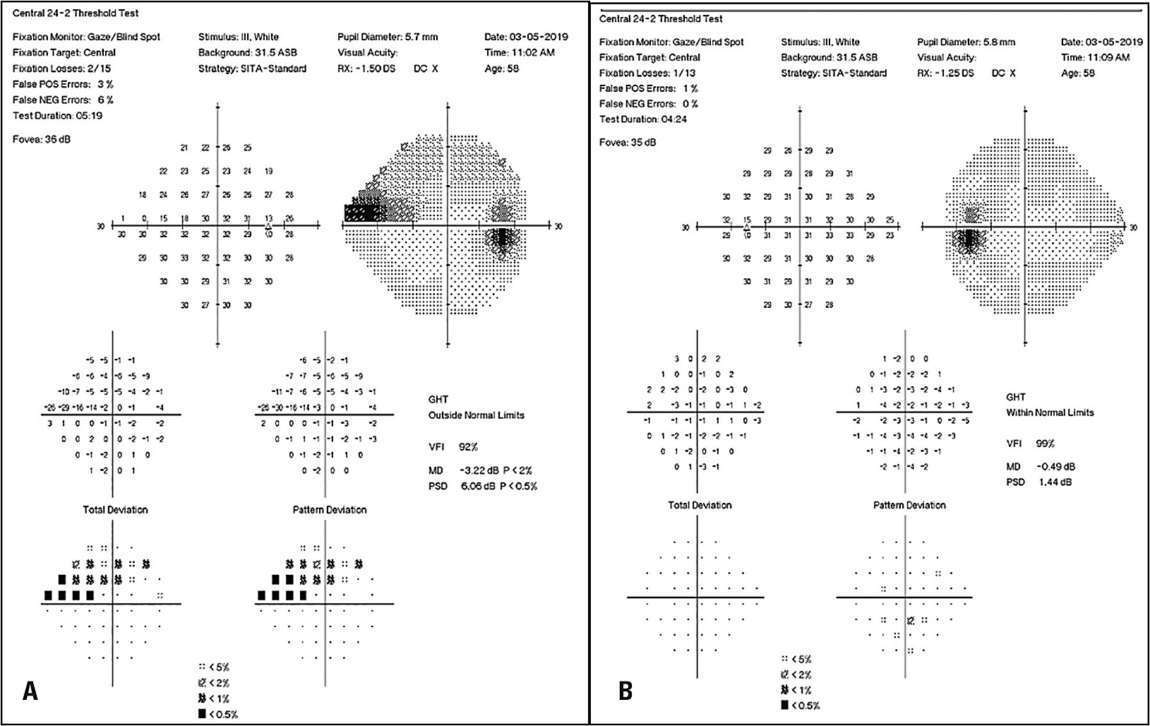 Glaucoma Physician | PentaVision