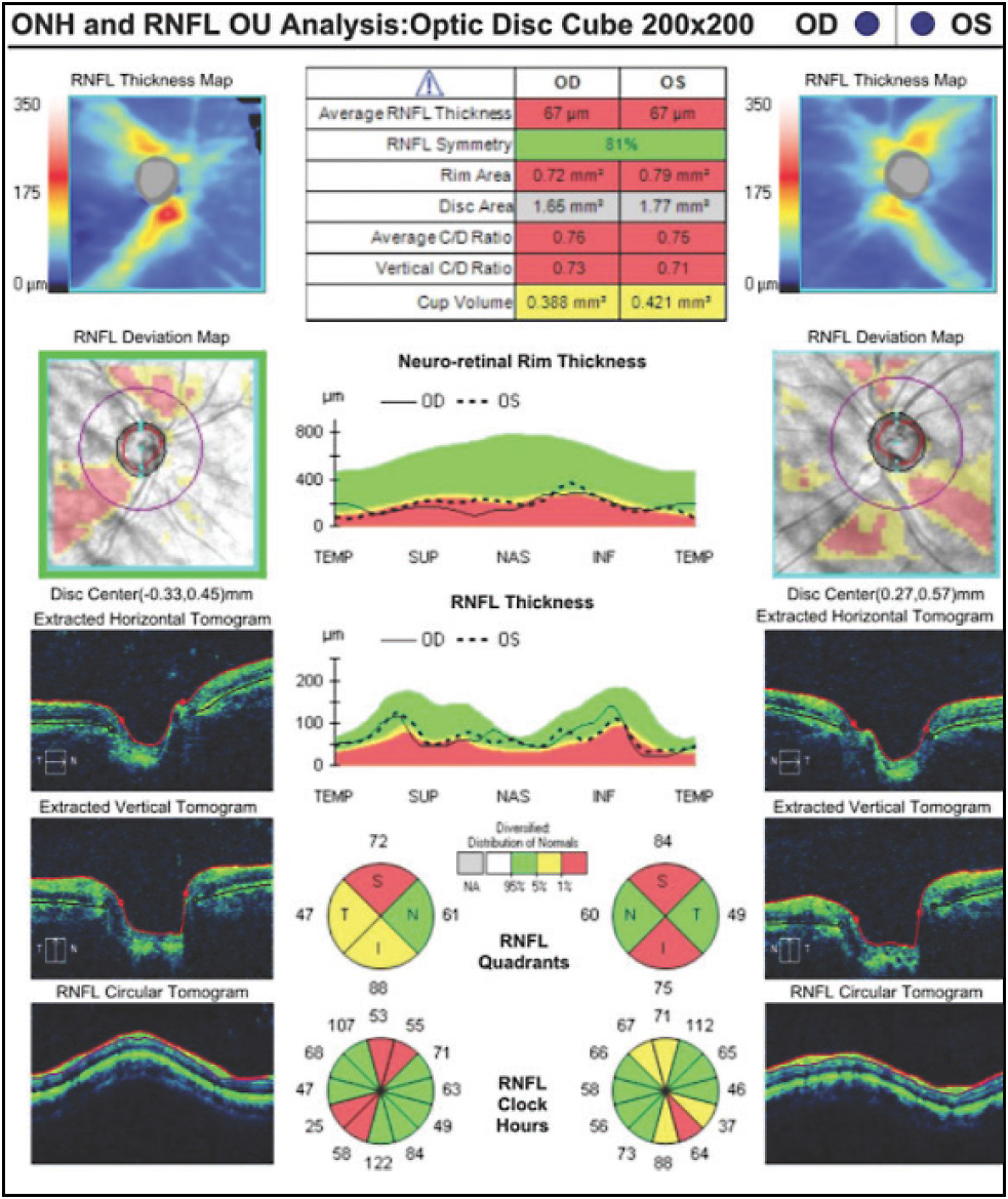 Glaucoma Physician | PentaVision